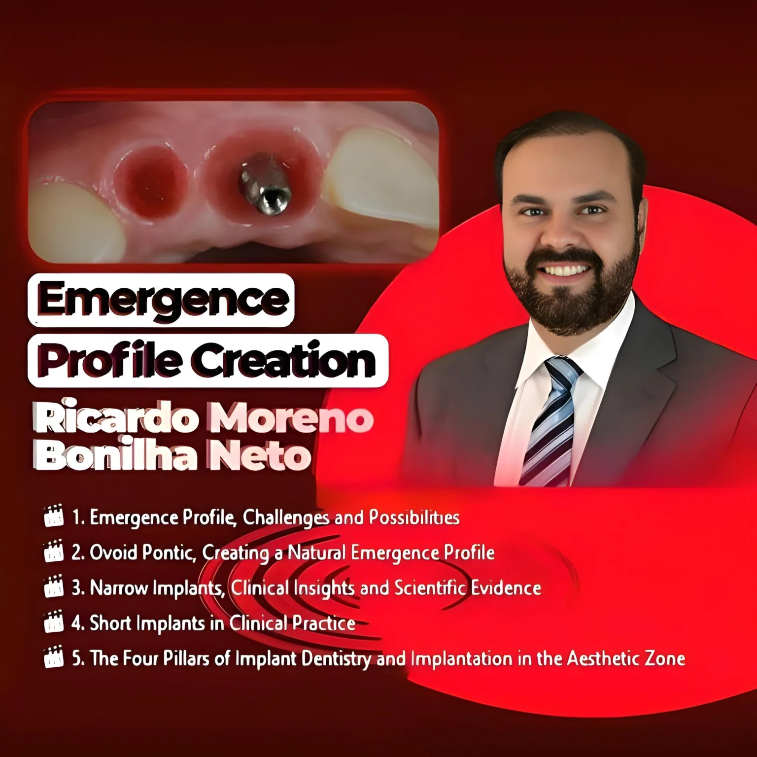 Emergence Profile Creation. Biologically Driven Implantology – Dental ... Emergence Profile Creation. Biologically Driven Implantology – Dental ...